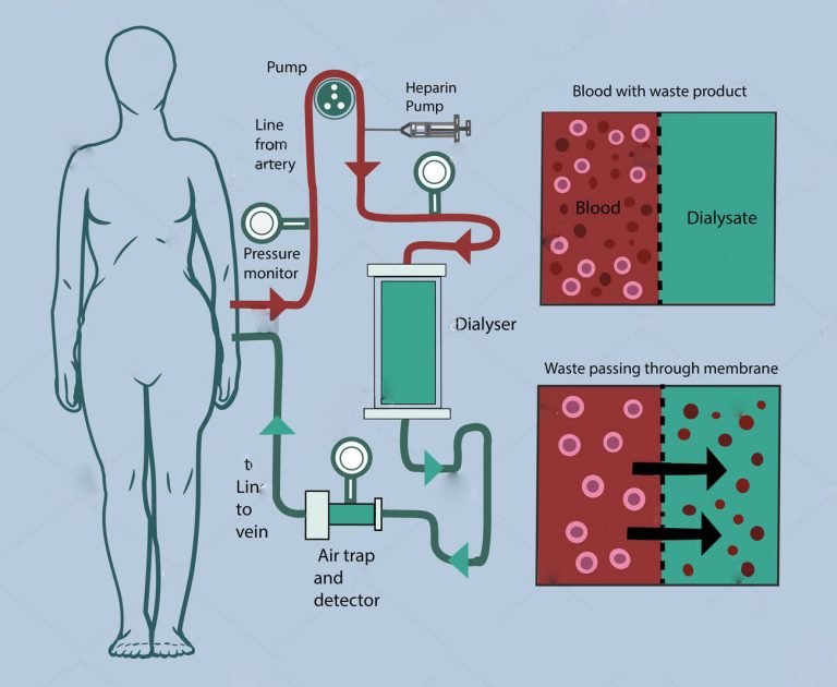 Dialysis and Transplantation – Sphinx Kidney Center